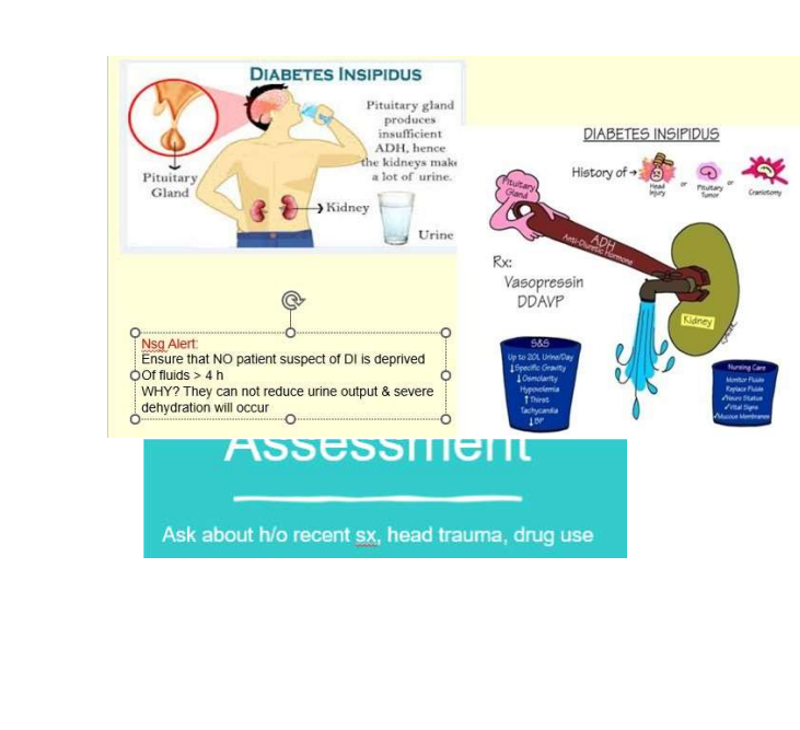 Diabetes Insipidus (DI) PATHOPHYSIOLOGY MAP 2025-2026 LATEST | Selnotes